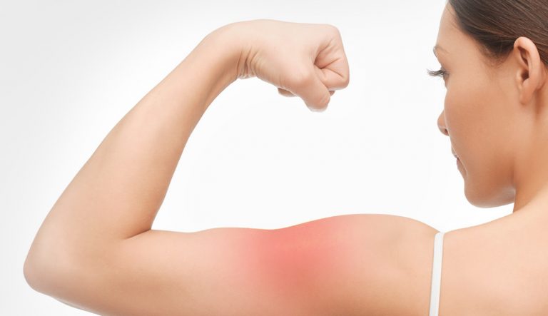 Gerinces Magazin » Hogyan kerüljük el a bicepsz sérüléseit?